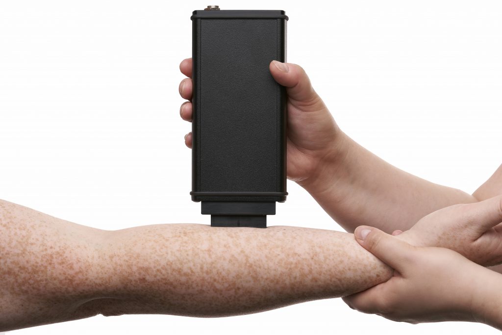 Translucency Meter application (2) | Dia-Stron